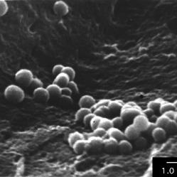 Endolith Advanced Collection